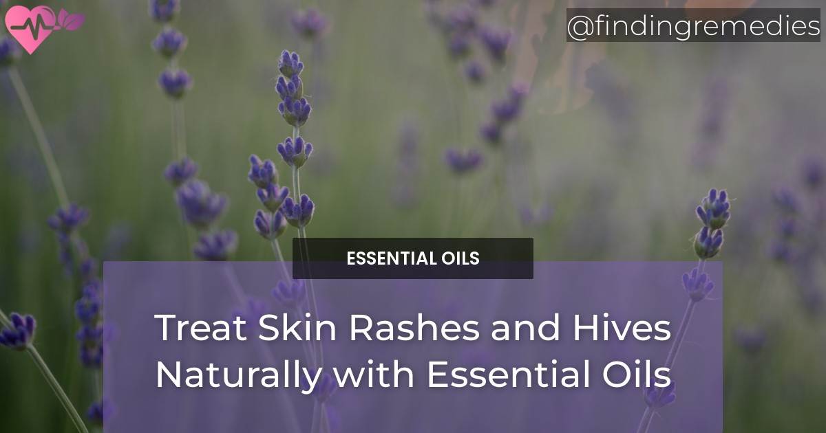 Treat Skin Rashes and Hives Naturally with Essential Oils - Finding ...